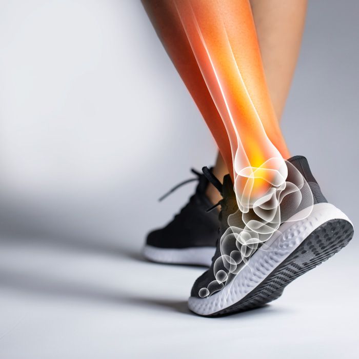 Drop Foot: What It Is, Causes, Symptoms & Treatment