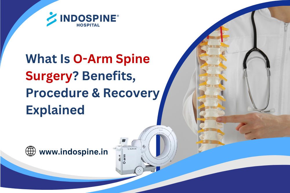 What Is O-Arm Spine Surgery:Benefits, Procedure & Recovery